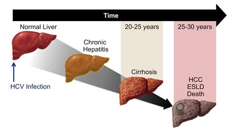 Core Concepts Evaluation Staging And Monitoring Of Chronic