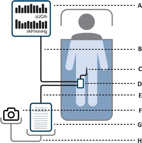 System Layout The Disposable Unit D Is Operated By The Controller Download Scientific