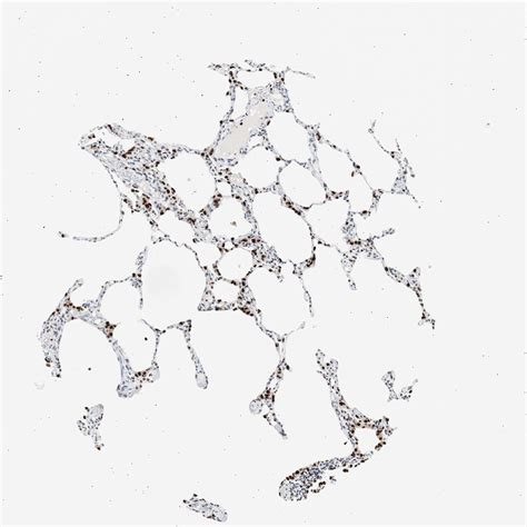 Tissue Expression Of Cebpb Staining In Lung The Human Protein Atlas