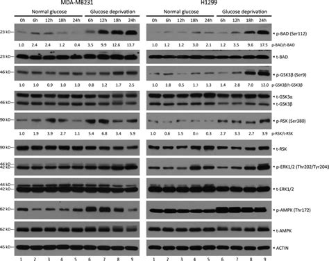 Glucose Deprivation Upregulates P90 Ribosomal S6 Kinase Rsk Activity