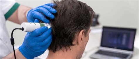 Unlocking Hair Density With Smp Scalp Evolution