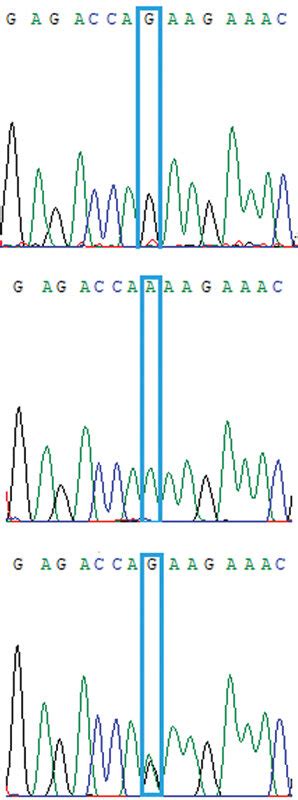 Sanger Sequencing Of Samples For Confirmation Of Hrm Pcr Sanger