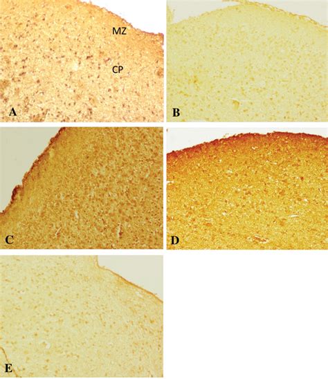 Immunostaining Of The Cerebral Cortex In The Experimental Group A Download Scientific