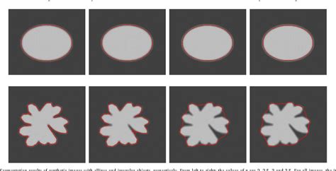 figure 1 from medical image segmentation based on level set and