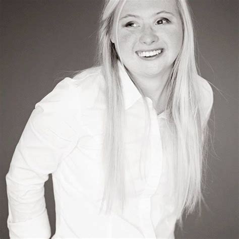 ဒေါင်းဆင်ဒရုန်း ဝေဒနာရှင်ဘဝကနေ နိုင်ငံတကာ မော်ဒယ်ဖြစ်လာခဲ့သူ Yoyarlay Digital Media And News