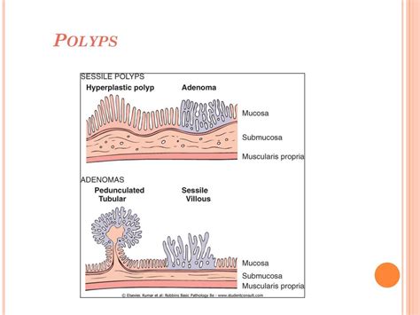 gastrointestinal block pathology lecture 2016 ppt download