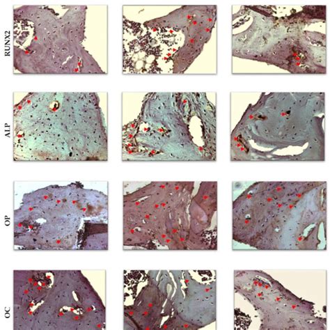 Runt Related Transcription Factor 2 Runx2 Alkaline Phosphatase Download Scientific Diagram