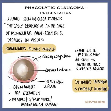 Phacolytic Glaucoma Ophthalmology Notes And Synopses