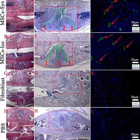 Hande Staining Hrp Dab And Immunofluorescence Staining For Gfp A D
