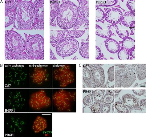 Block Of Spermatogenesis And Apoptosis Of Mid Pachytene Spermatocytes