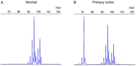 Microsatellite Instability Analysis Microsatellite Instability Low Was