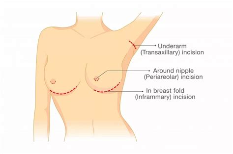 Natural Breast Shapes And Sizes