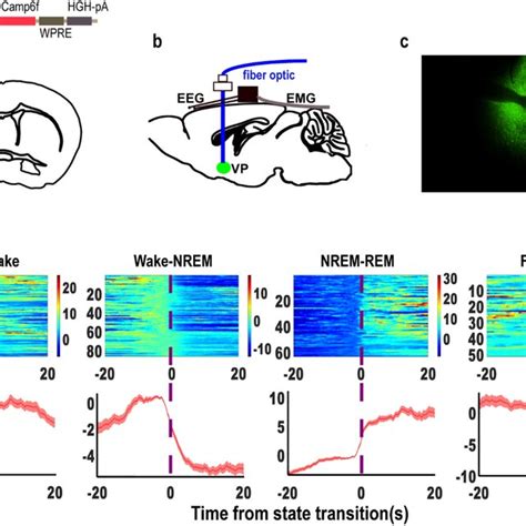Delineation Of The Anterior Ains And Posterior Pins Insular Cortex Download Scientific