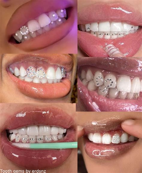 Discover 34 Tooth Gems And Grills Ideas Tooth Gem Pretty Teeth