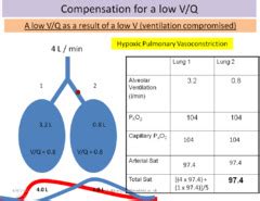 V Q Ratios Of The Lungs 2 62 Flashcards Quizlet