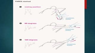 Shoulder Dislocation 1pptx