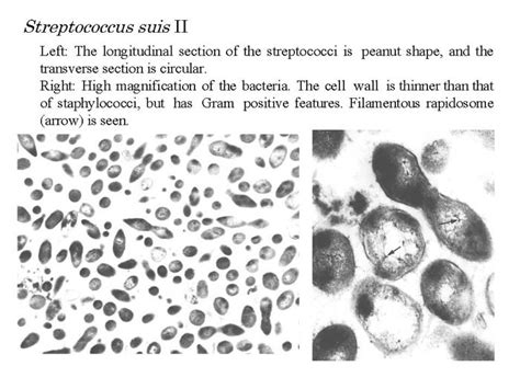 Niahniah Pathogenic Organisms Observed By Electron Microscope
