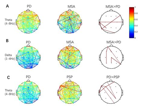 Functional Connectivity Maps Of The Pd And Msapsp Groups In Various