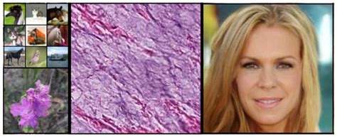 Memorizing Swin Transformer Denoising Network For Diffusion Model