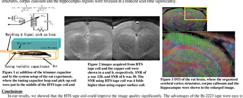 Figure 3 From Non Invasive Fiber Tracking On Diffusion Tensor Mri Using High Temperature