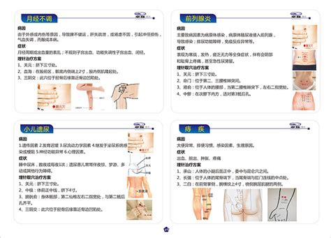 卓脉揿针埋针治疗穴位操作图示 快乐每一天 杭州领卓医疗器械有限公司