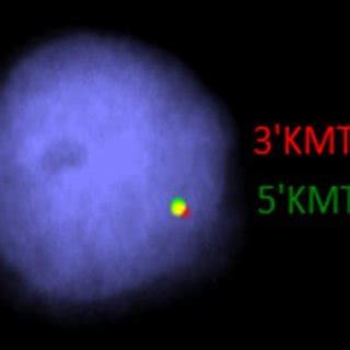 Interphase Fish Result For The Etv Runx Dual Colour Single Download Scientific Diagram