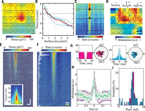 Learning Enhanced Coupling Between Ripple Oscillations In Association Cortices And Hippocampus Pmc