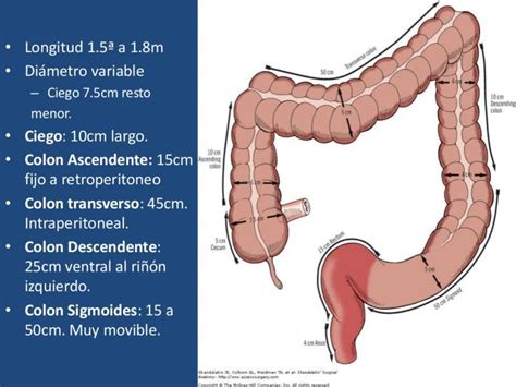 Tumor de Colon - Cirujano Monterrey