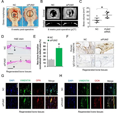 Transplantation Of Mscs With Pum Kd Enhances In Vivo Bone Regeneration