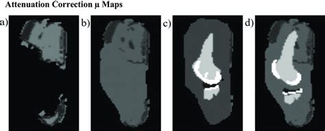 Attenuation Correction µ Maps Generated In Four Ways Of Varying Download Scientific Diagram