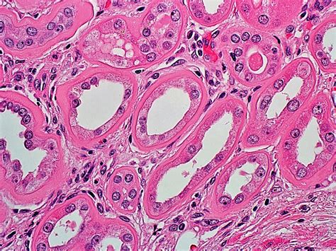 Glomerular Basement Membrane Histology