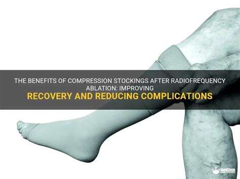 The Benefits Of Compression Stockings After Radiofrequency Ablation Improving Recovery And