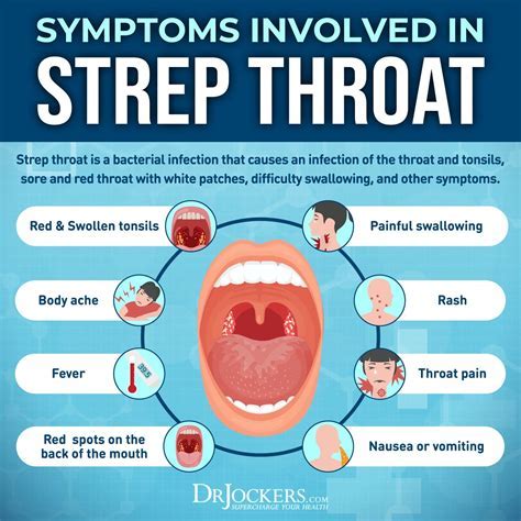 When Is Strep Throat No Longer Contagious With Antibiotics