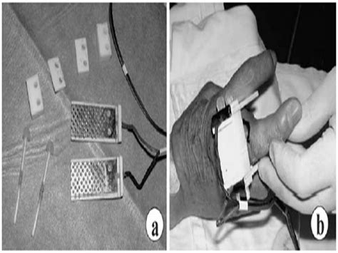 Electrode Medical Uses At Gene Courtney Blog