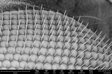 Dinoflagellates Under Electron Microscope