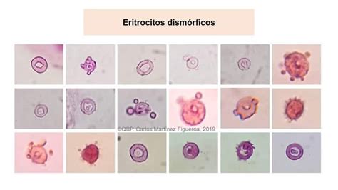 Eritroc Federación De Ciencias De La Salud Latino America