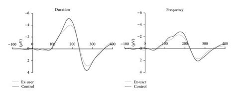 a mismatch negativity mmn waveforms at fz displayed for each