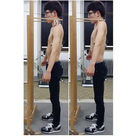 Scapular Upward Rotation Across Three Shrug Exercises Mean ± Sd Download Scientific Diagram