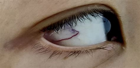 Нүдний эмчийн зөвлөгөө Оройн мэнд