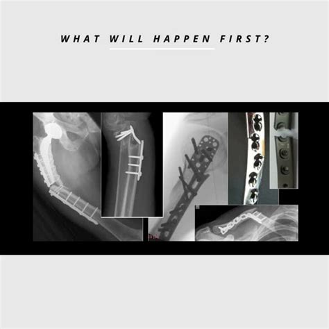 David Lembo Posted On Linkedin