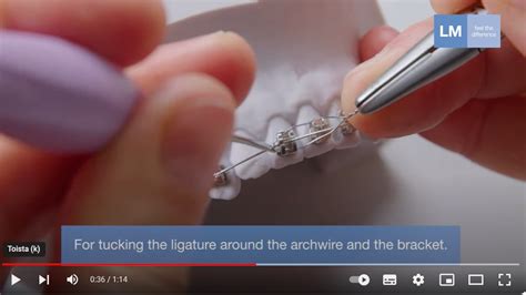 How To Use Ligature Director Instrument Lm Dental