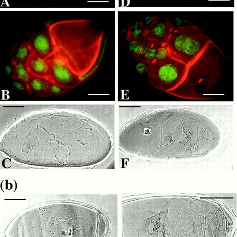 Mammalian β Catenin And Plakoglobin Interact With Dα Catenin And