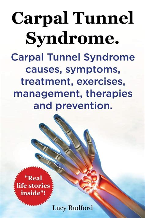 Carpal Tunnel Syndrome Cts Carpal Tunnel Syndrome Cts Causes Symptoms