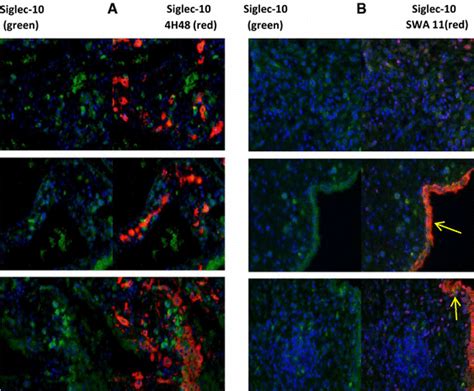 Expression Of Siglec 10 In First Trimester Placental Bed A Siglec 10 Download Scientific