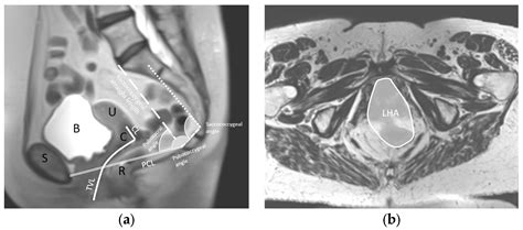 Jcm Free Full Text Explorative Identification Of Anatomical