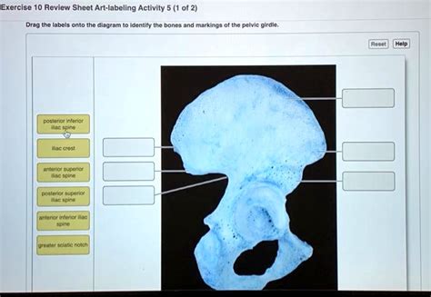 Exercise 10 Review Sheet Art Labeling Activity 5 1 Of 2 Drag The Labels Onto The Diagram To