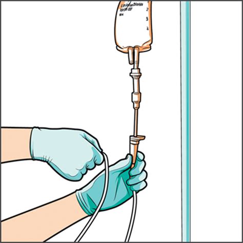 Ra Rituxan® Rituximab Infusion Steps And Resources