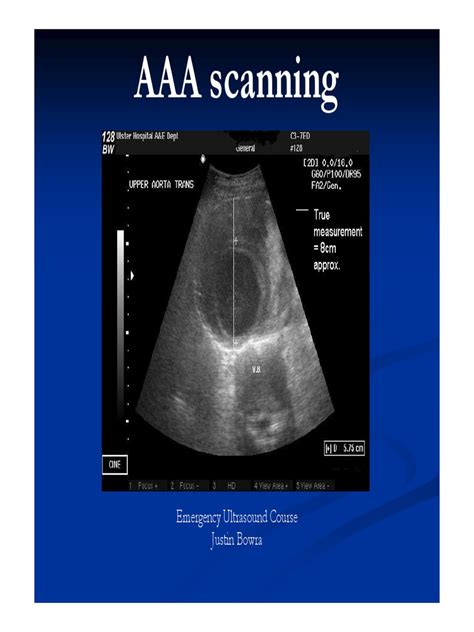 Aaa Scanning Emergency Ultrasound Course Justin Bowra Pdf Aorta