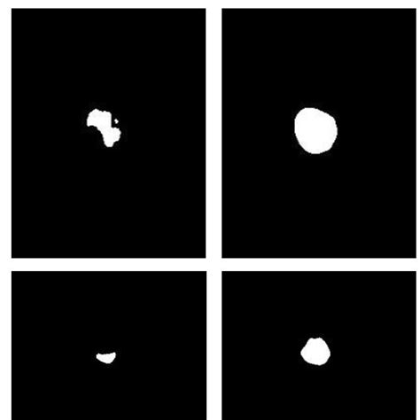 Qualitative Segmentation Results Of U Net And The Proposed Model On The Download Scientific