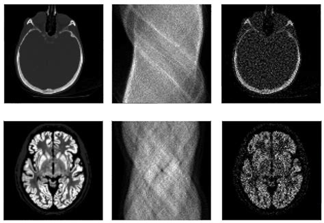 top row shows the ct 96×96 phantom and its noisy sinogram 96 bins